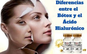Diferencias entre el Botox y el Ácido Hialurónico