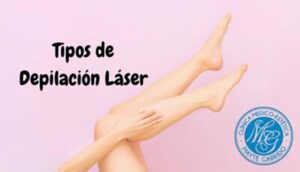 Tipos de Depilación Láser- ¿Cuál es la Indicada para ti?
